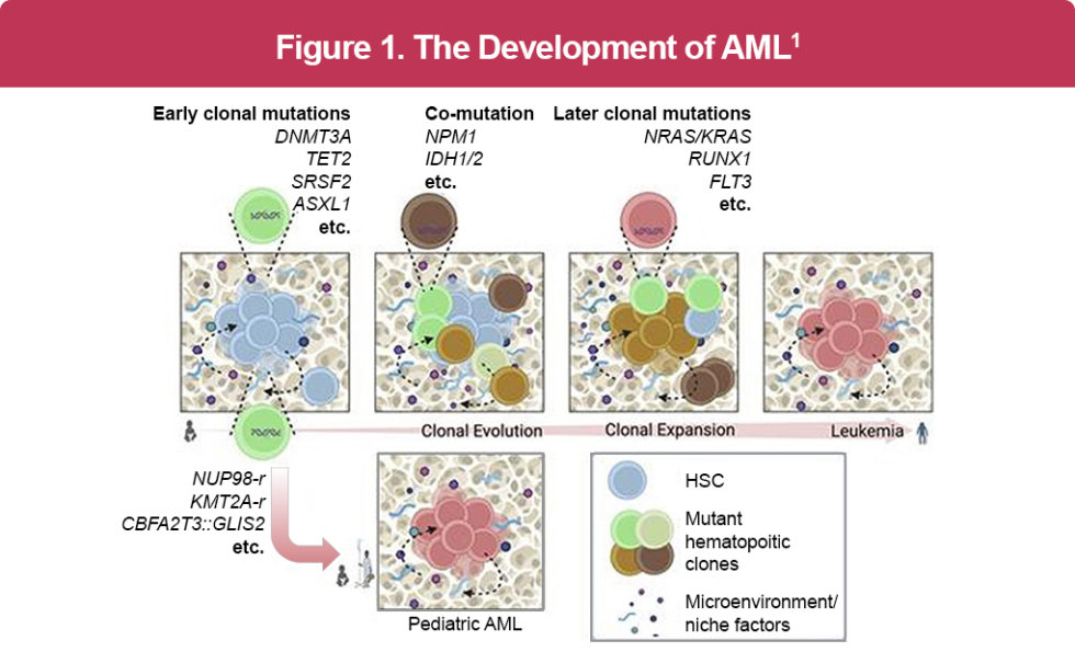 Understanding Acute Myeloid Leukemia | Leukemia